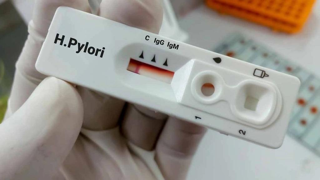 Riesgo: 70% de mexicanos con bacteria asociada al cáncer gástrico ...